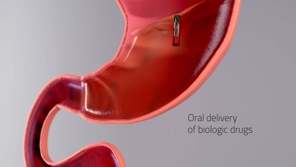 A luminal unfolding microneedle injector for oral delivery of ...